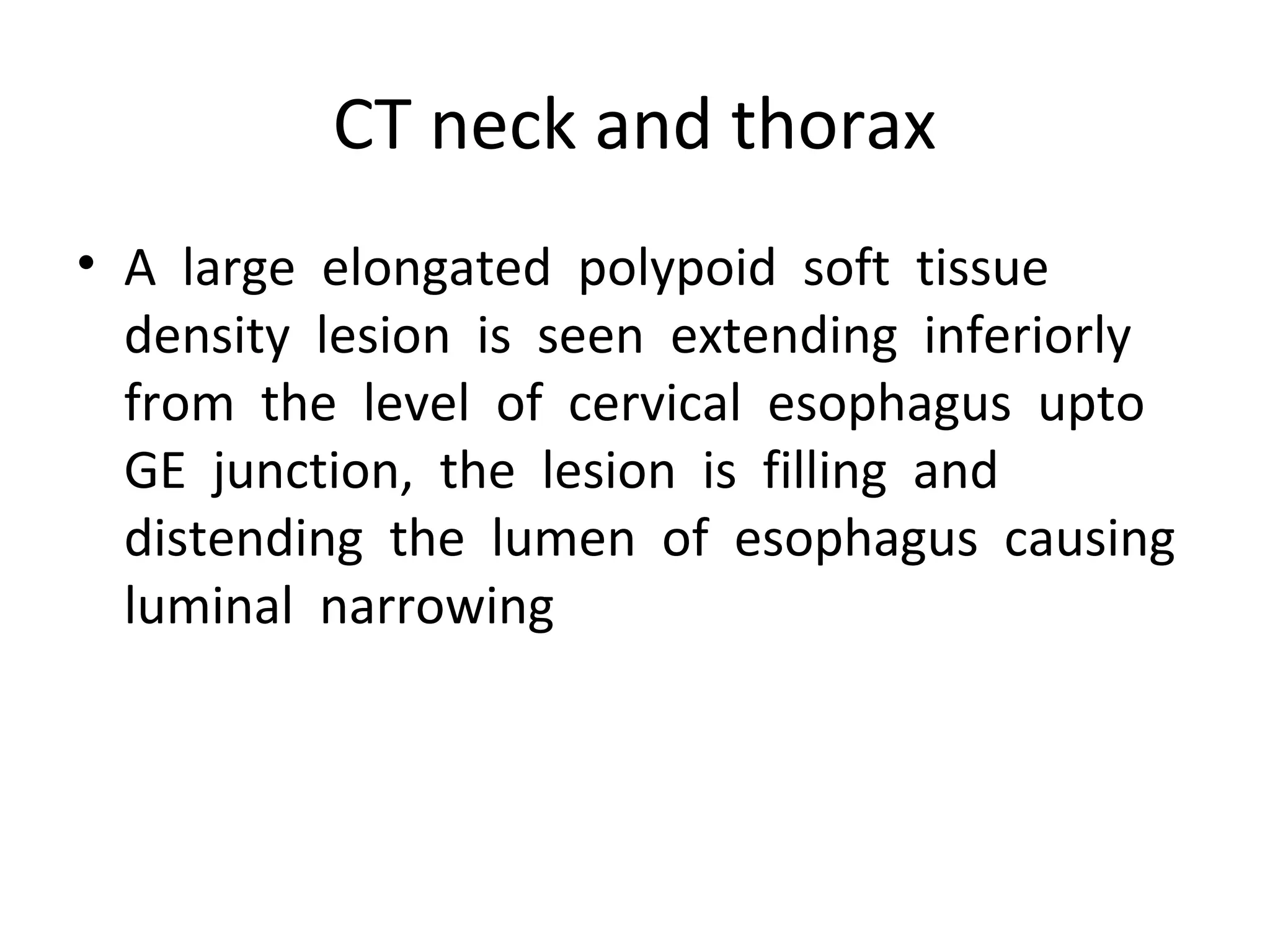 Fibrovascular polyp | PPT