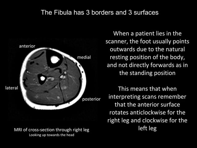 Fibula.pdf