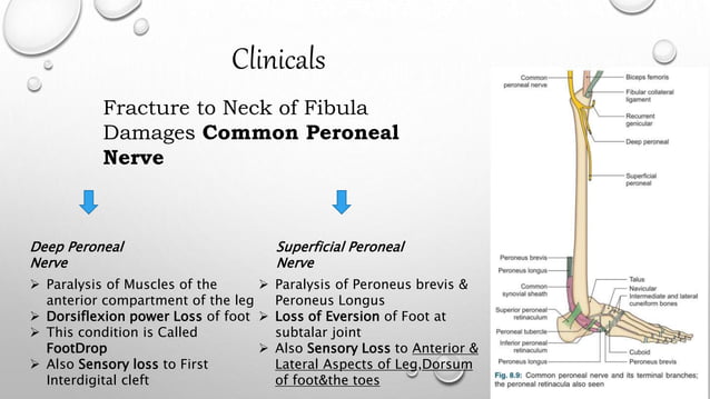 Anatomy of Fibula with Muscle Attachments.pptx | Death, Injury, or ...