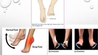 Anatomy of Fibula with Muscle Attachments.pptx