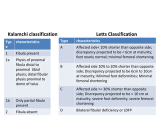 Fibular deficiency and management.pptx
