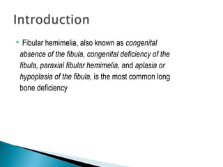 Fibular hemimelia | PPT