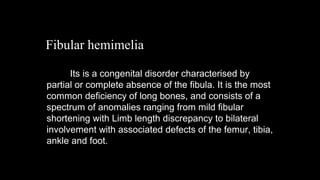 Fibular hemimelia | PPT