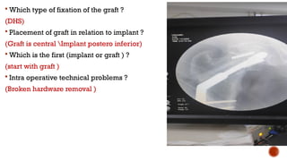 Fibular strut graft enhance neck femur union in.pptx