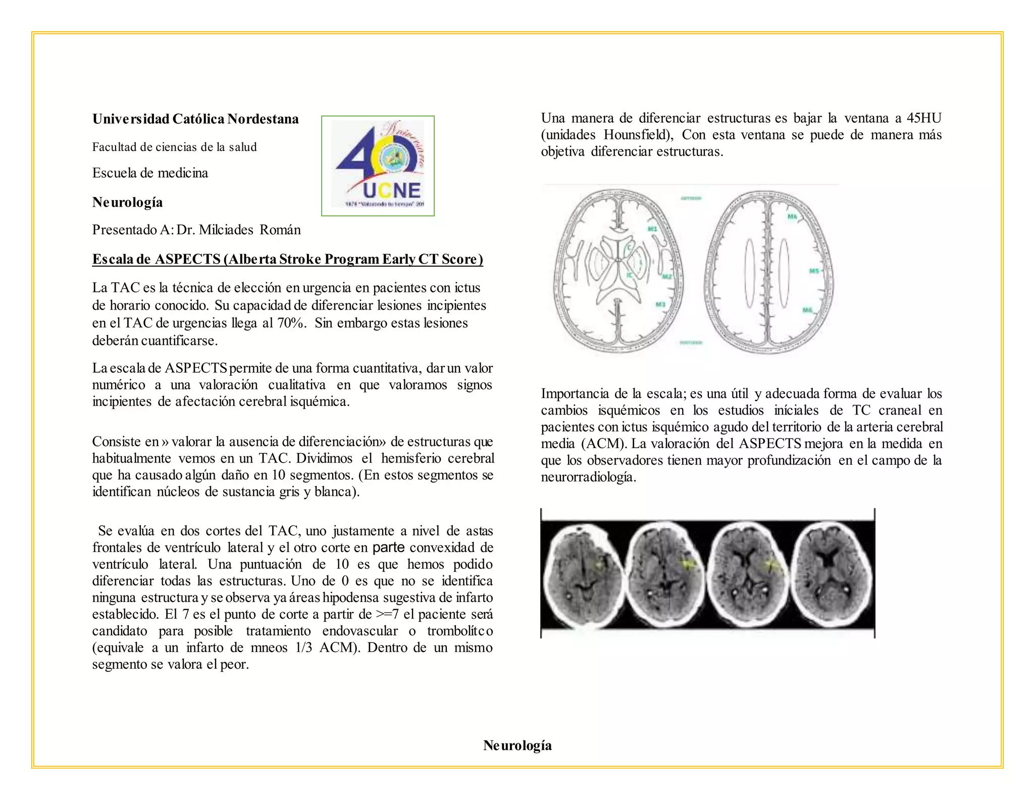 Neurologia escala de ASPECT evaluacion de un paciente neurologico | DOCX