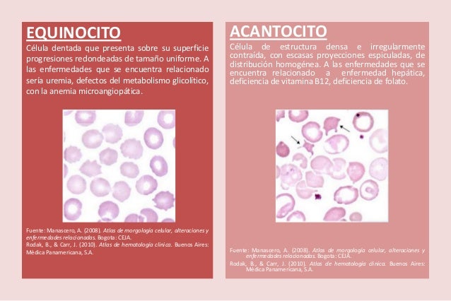 Fichero de hematología