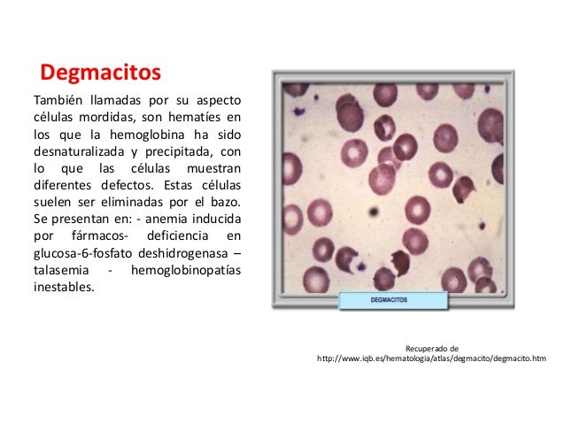 Fichero hematología