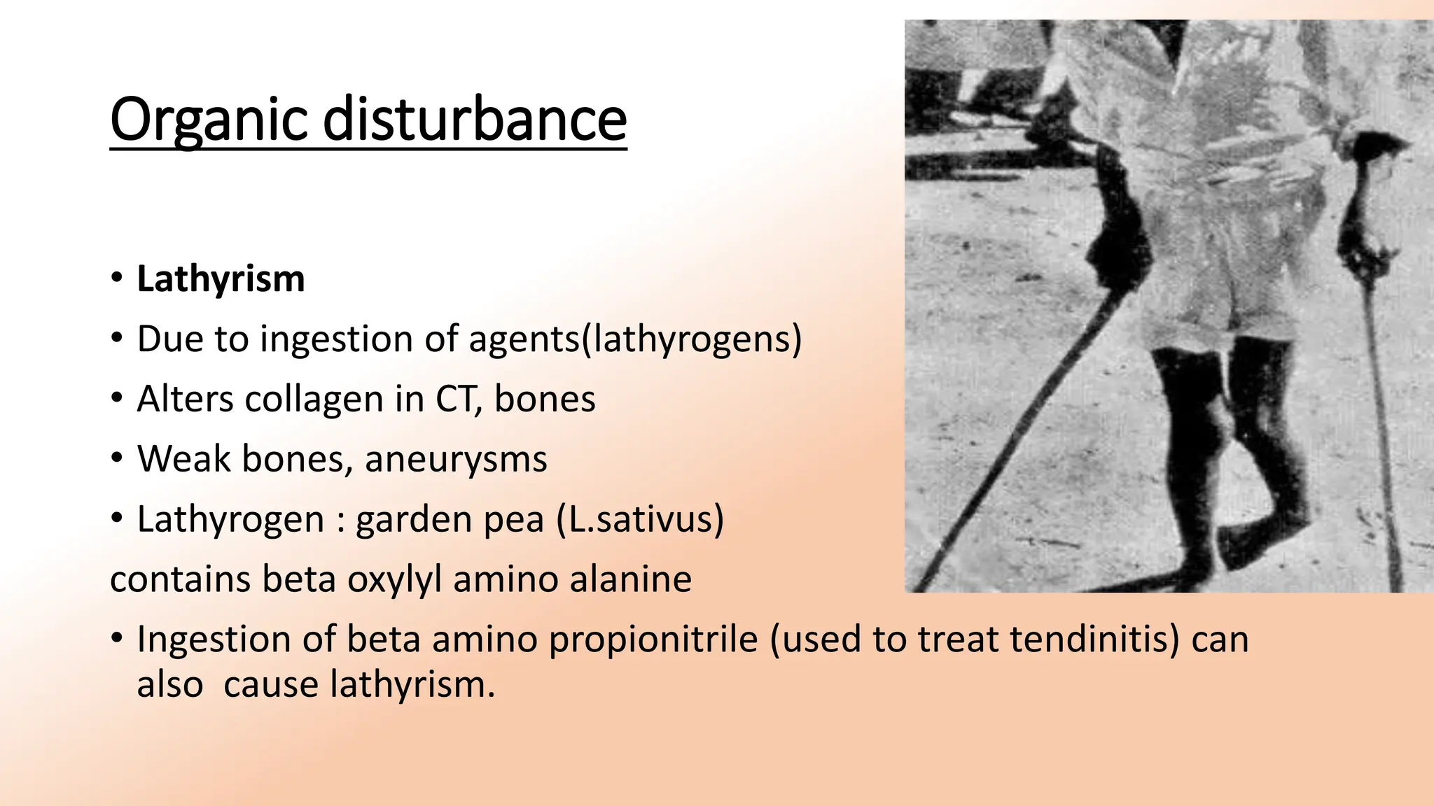 metabolic disorders seen in Orthopedics .pptx