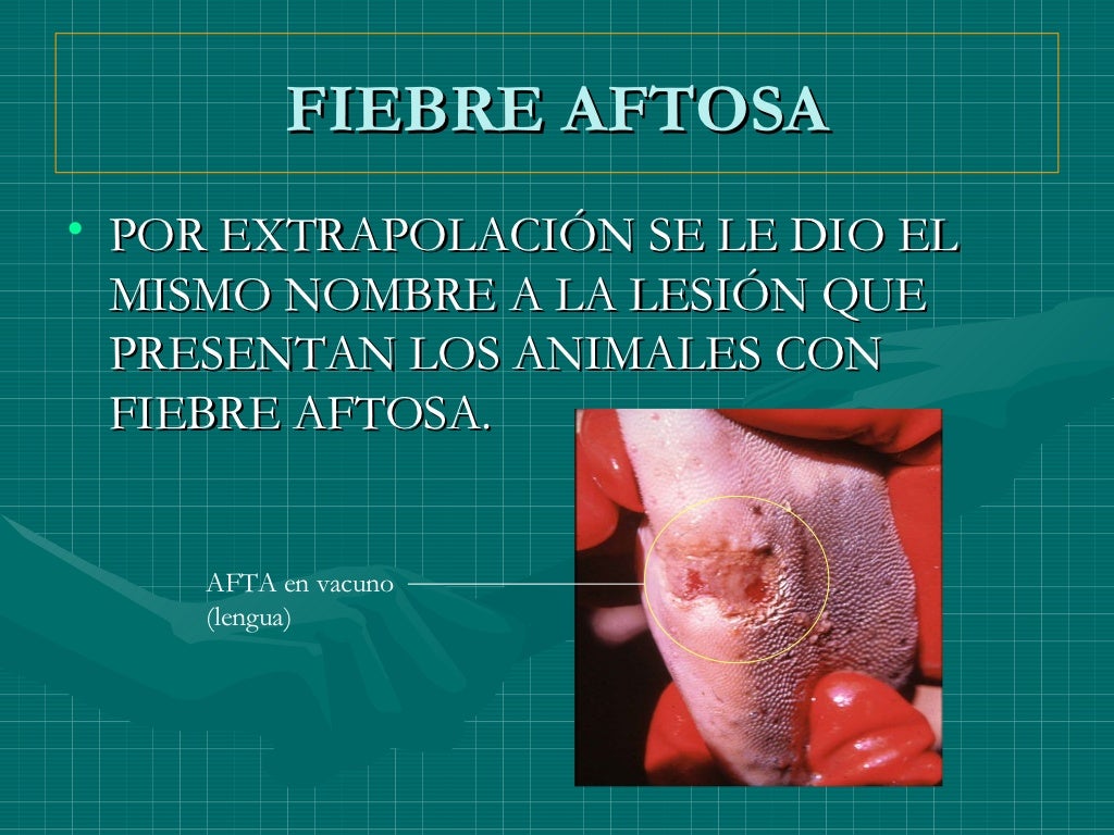 Fiebre Aftosa