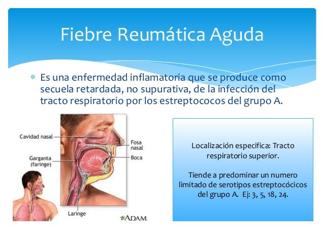 Fiebre reumatica