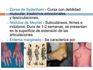 Fiebre reumatica conalep 171 | PPTX