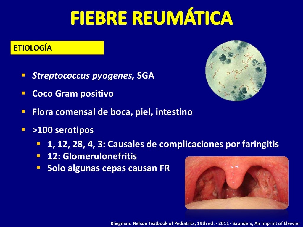 Fiebre reumatica