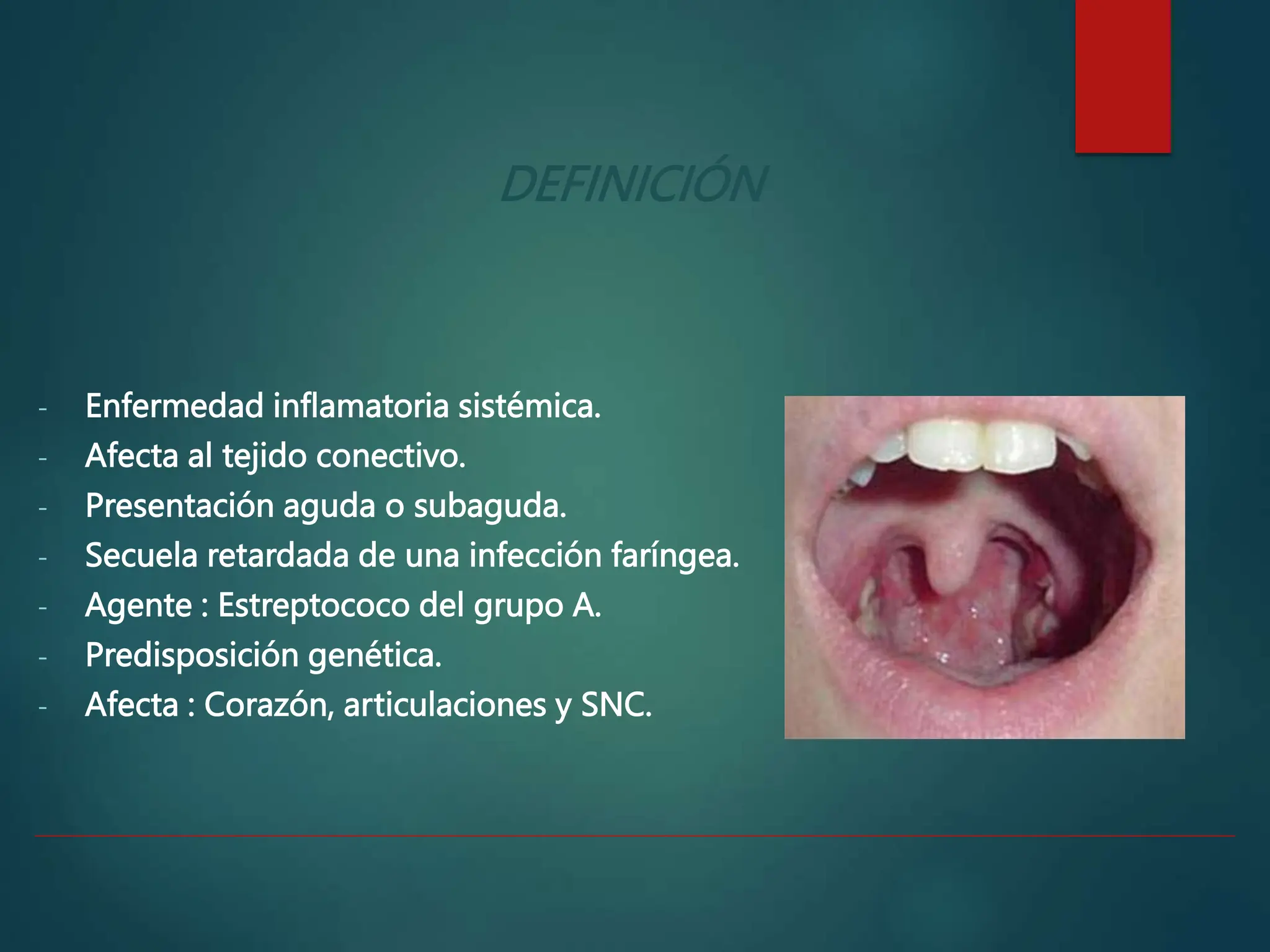 FIEBRE REUMATICA EN NIÑOS.pptfgcgghgfghvgv | PPT