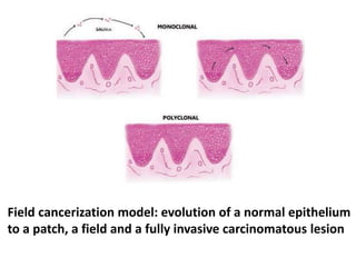 Field cancerization | PPTX