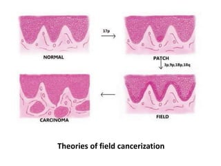 Field cancerization | PPTX