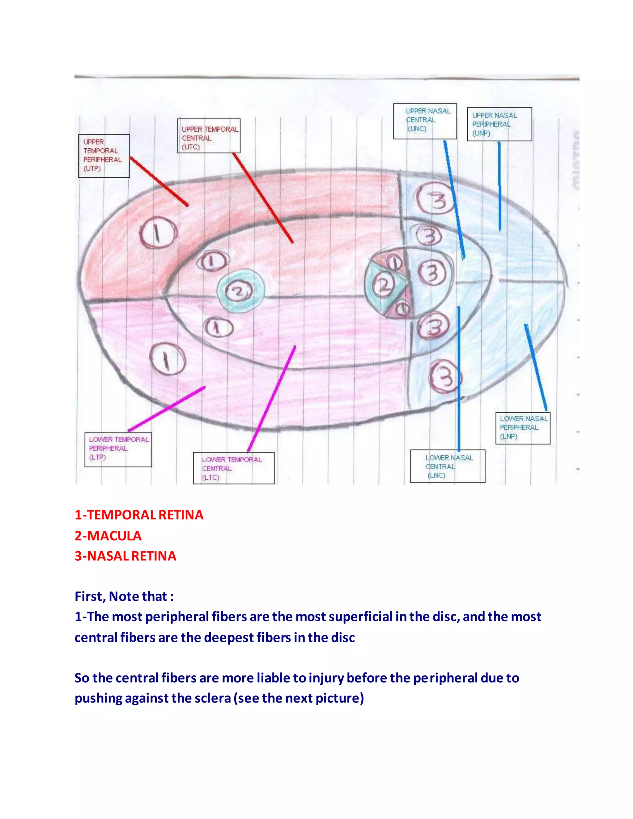 Field changes in glaucoma | DOC | Eye and Vision Conditions | Diseases ...