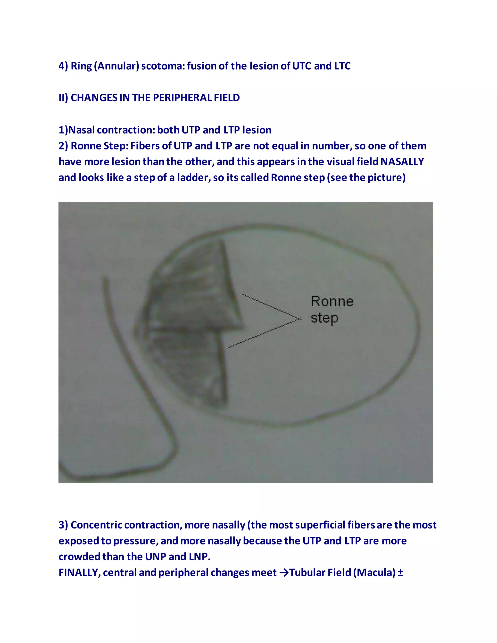 Field changes in glaucoma | DOC | Eye and Vision Conditions | Diseases ...