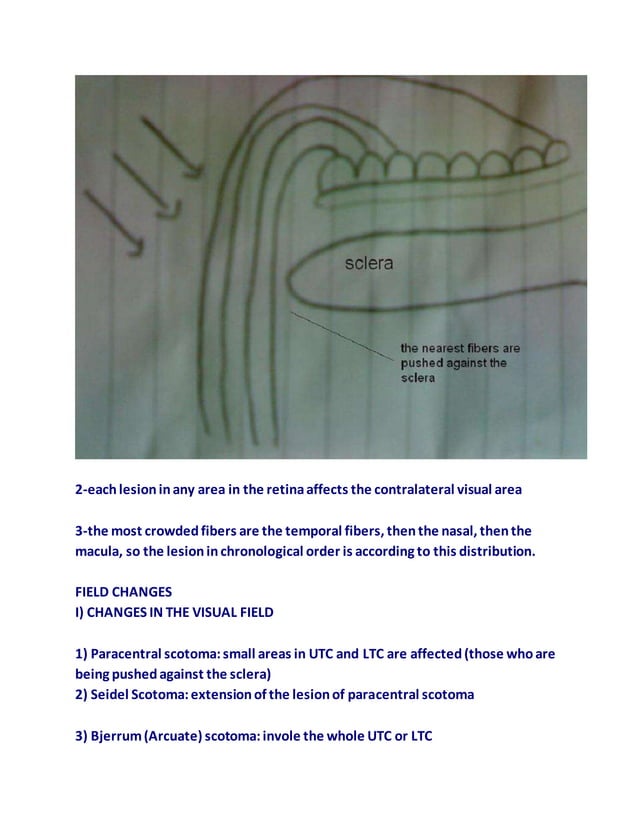 Field changes in glaucoma | DOC | Eye and Vision Conditions | Diseases ...