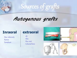 application of bone graft in dentistry | PPT