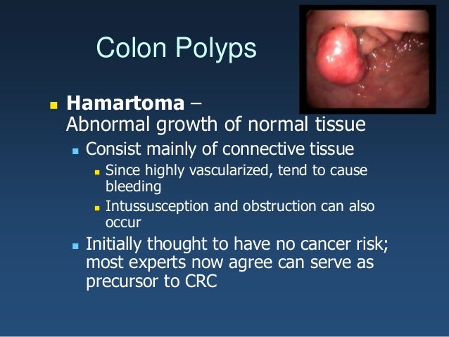 January 2015 CRCWebinar Inherited Syndromesl