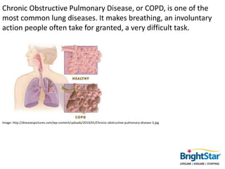 Fighting COPD | PPTX