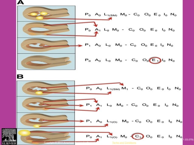 FIGO abn ut bleeding board, in genetal t | PPT