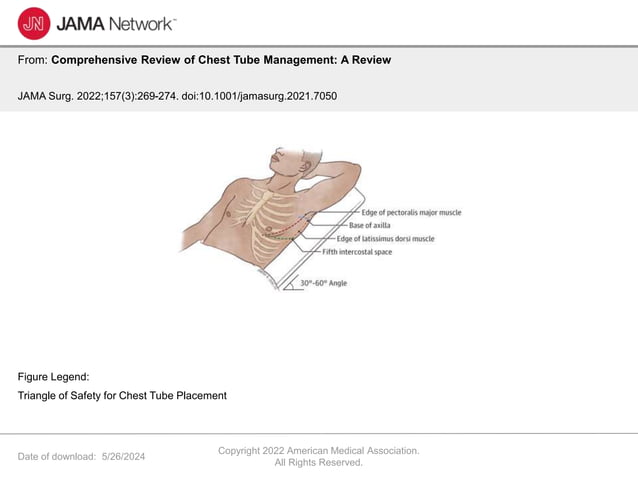 Jama journal chest tube insertion 2022 ppt | PPT