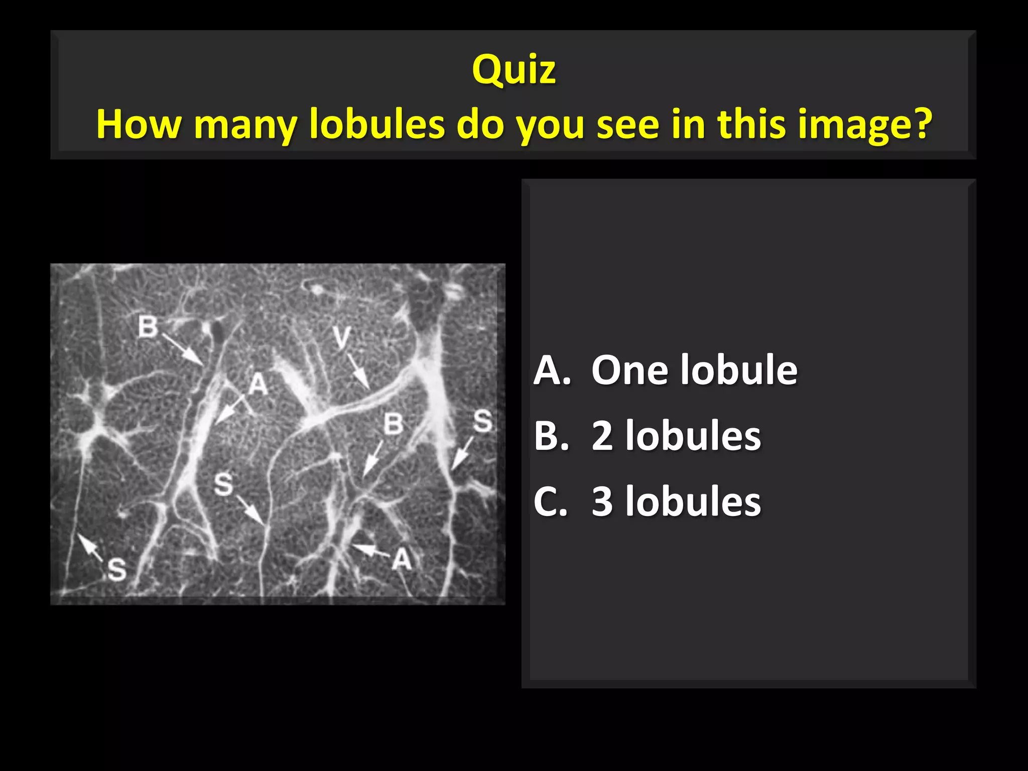 Figure 3 sign fleischner sign-fissure sign-headcheese sign-hilar ...