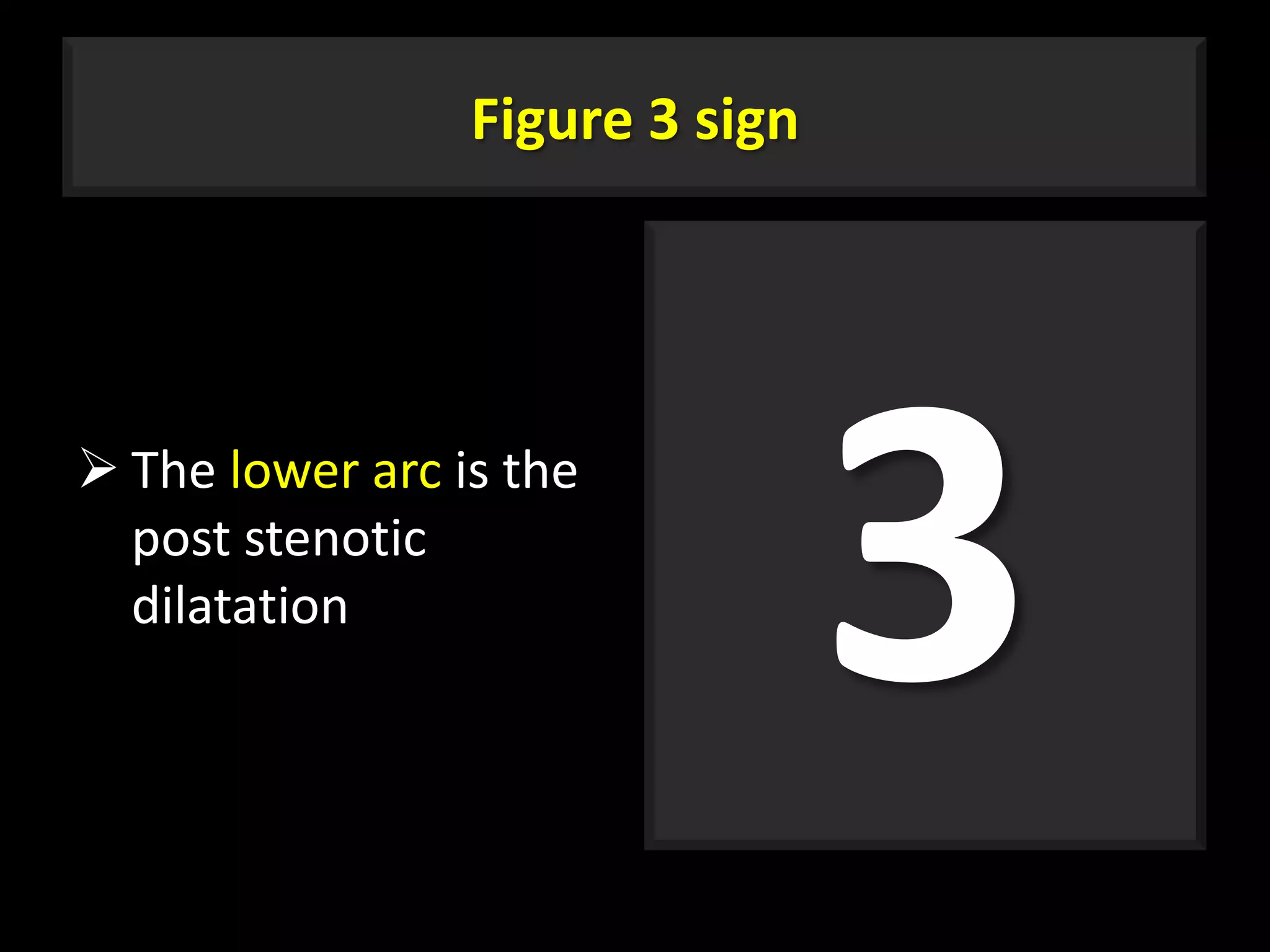 Figure 3 sign fleischner sign-fissure sign-headcheese sign-hilar ...