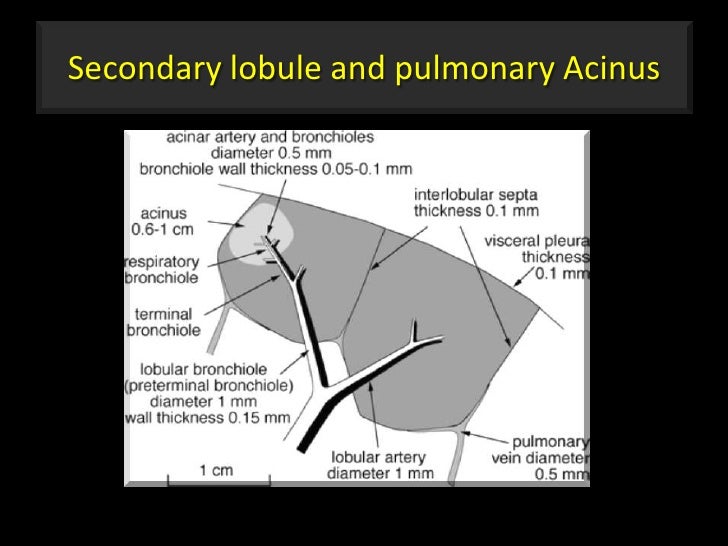Figure 3 sign fleischner sign-fissure sign-headcheese sign-hilar over…