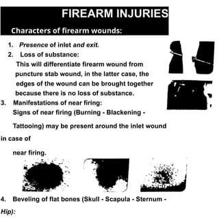 Firearm injury and firearmweapons ppt.doc