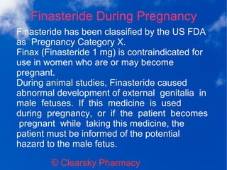 Finax (Finasteride 1 mg Tablets) | ODP