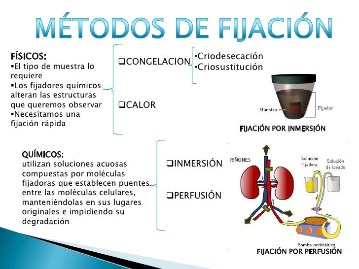 Fijación