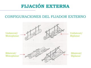 Fijacion externa | PPT