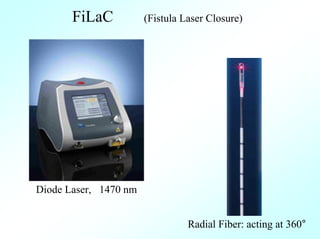 FILAC - Dr. Paolo Giamundo, Dept. of General Surgery– Hospital S ...