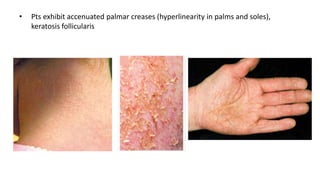 Filaggrin mutation associated disorders | PPTX