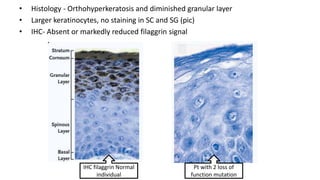 Filaggrin mutation associated disorders | PPTX