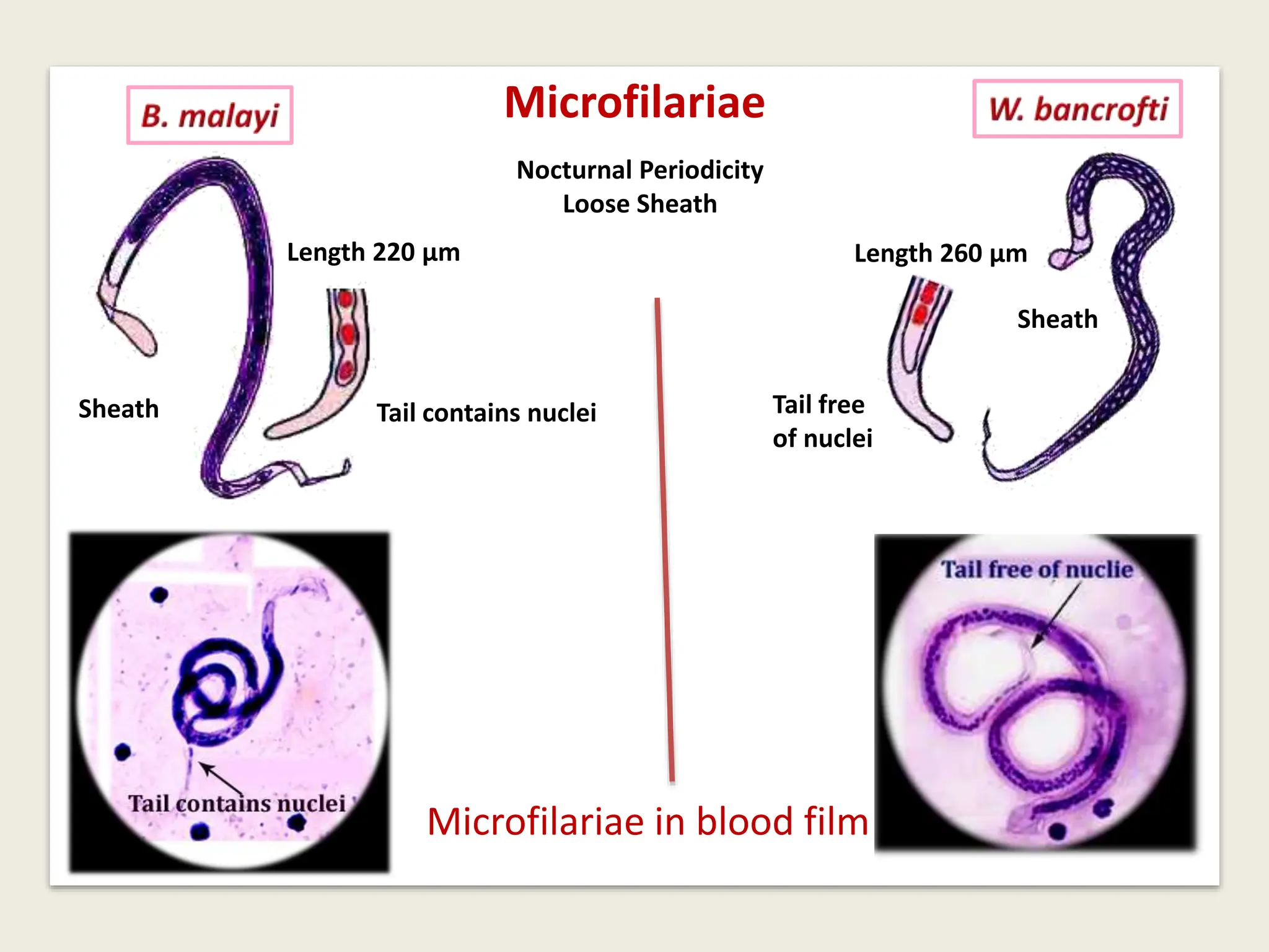 Filariae species & Lymphatic filariasis.pptx