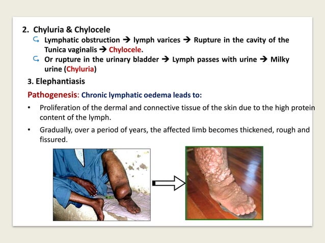 Filariae species & Lymphatic filariasis.pptx
