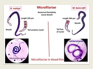 Filariae species & Lymphatic filariasis.pptx