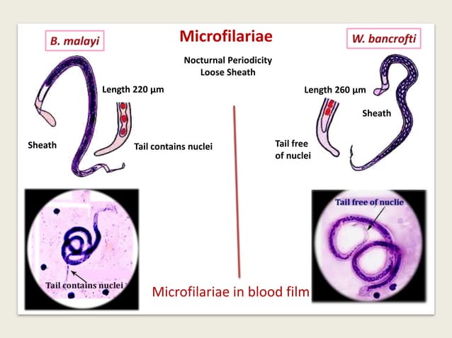 Filariae species & Lymphatic filariasis.pptx