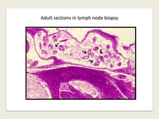 Filariae species & Lymphatic filariasis.pptx