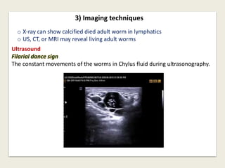 Filariae species & Lymphatic filariasis.pptx
