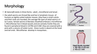 Filaria part 1 | PPTX