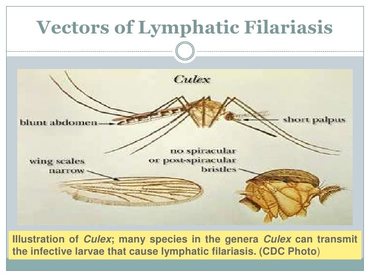 Filariasis