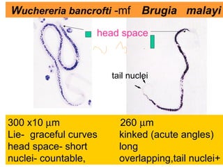 Brugia Malayi And Wuchereria Bancrofti