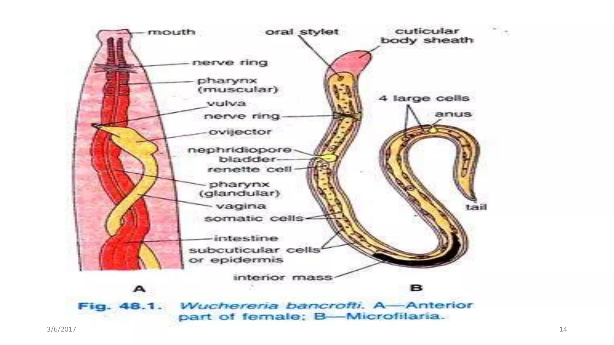Filariasis | PPTX