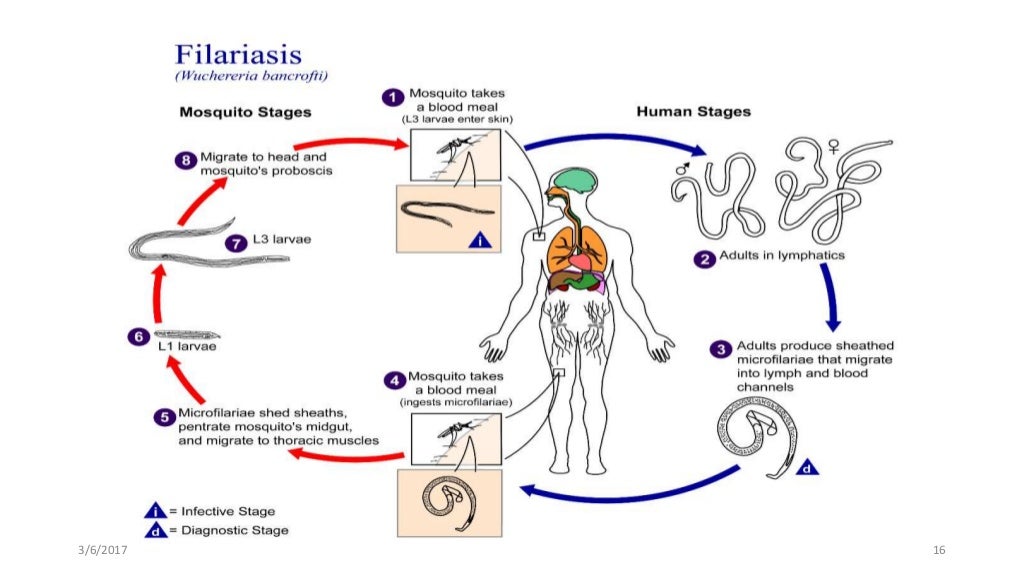 Filariasis