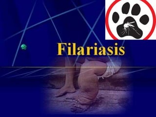 Filariasis | PPTX