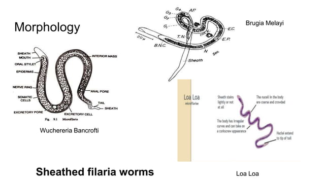 Filariasis | PPT